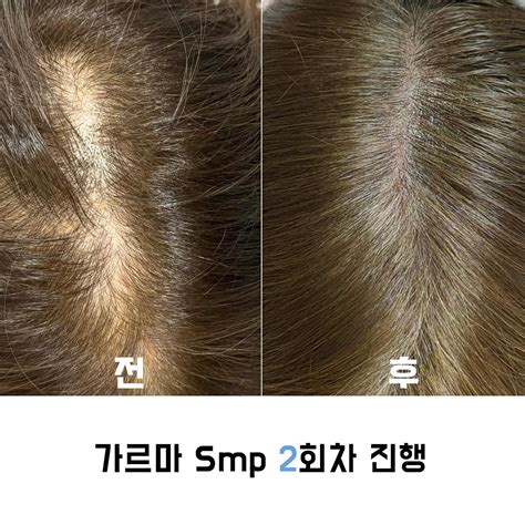 성신여대눈썹문신 남자눈썹문신 수유눈썹문신 성신여대속눈썹 반영구수강 반영구학원 혜화눈썹문신 🥇원장 이종민 [시술 직후