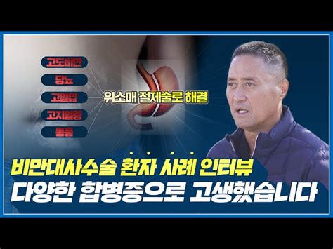 위소매절제술은 당뇨에도 효과 있을까 수술환자를 만나다 더 뉴스 메디칼 인터뷰