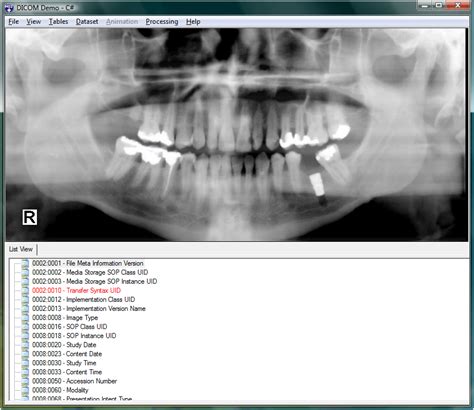 leadtools pacs imaging sdk