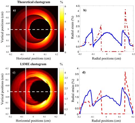 ͑ A ͒ Theoretical Radial Strain Elastogram Computed With Ansys Fe