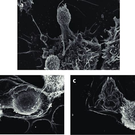 Histopathology Of Cryptococcus Neoformans Lung Infection Download Scientific Diagram Histopathology Of Cryptococcus Neoformans Lung Infection Download Scientific Diagram