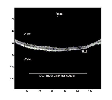 Schematic Diagram Of The 2d Simulation Model Detailed Parameters Of The Download Scientific