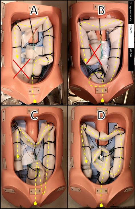 Colon Configurations AD These Configurations Are Based On 19 And Download Scientific