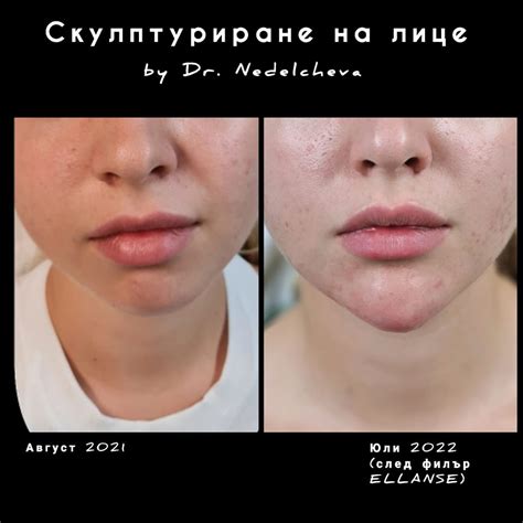 Ако някой от Дерматологичен център Д р Неделчева Facebook