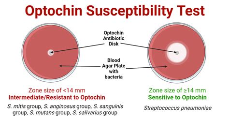 Bacitracin Sensitivity Test
