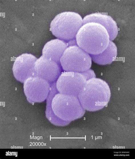 Alpha Hemolytic Strep On Bao