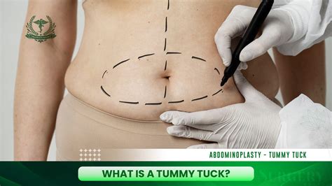 Tummy Tuck Abdominoplasty Tran Plastic Surgery
