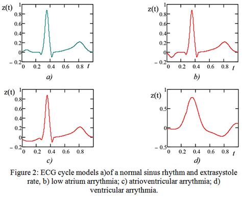 The Use Of Digital Signal Processing Algorithms For
