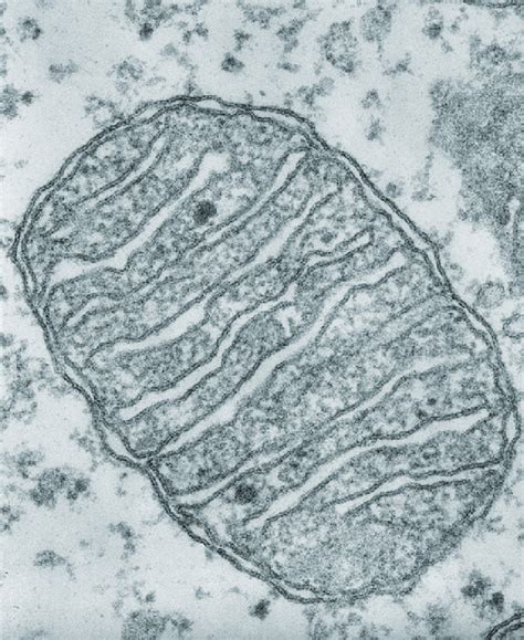 Electron Micrograph Of Mitochondria Labelled