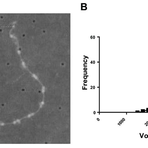 3d Structure Of Collagen Vi Microfibril A Cryo Tem Structure Of