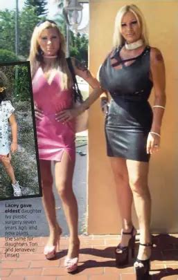 Lacey Wildd Plastic Surgery Before And After Where Is She Now