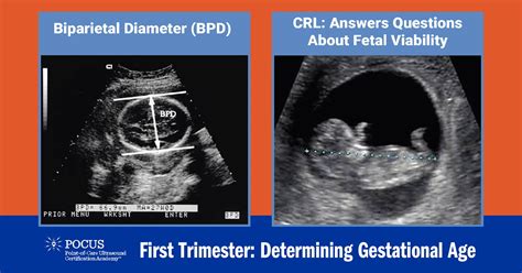 First Trimester Determining Gestational Age Pocus Resources And Case