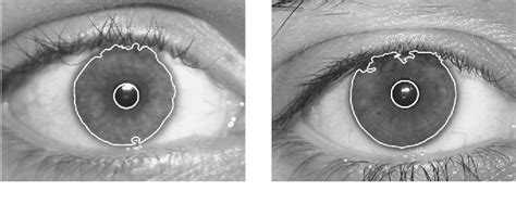 Figure 22 From Iris Segmentation Using Geodesic Active Contours