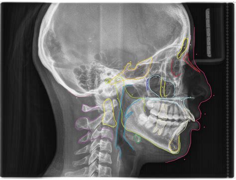 Juegos De Ciencias Juego De Estructuras Anatomicas De Lateral De
