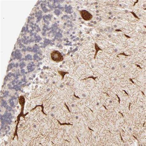 Factor V Antibody Novus Biologicals™ 01ml Unlabeled Fisher Scientific