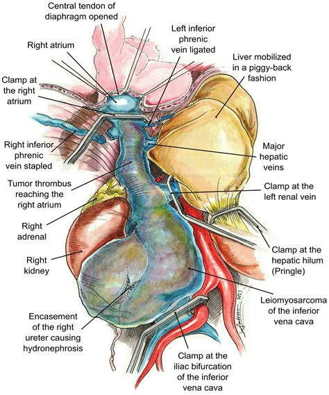Inferior Vena Cava Cardiovascular Anatomyzone