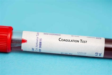 Costo Efectividad De Anticoagulantes Orales Nuevo Estudio