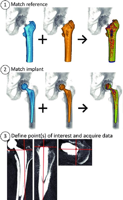 Ctma Basic Workflow Step 1 Identify The Reference Body Femur In Download Scientific Diagram