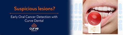 Early Oral Cancer Detection Improve Patient Outcomes