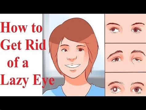 How To Get Rid Of A Lazy Eye