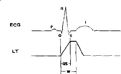 Figure 2 From A Robust Open Source Algorithm To Detect Onset And