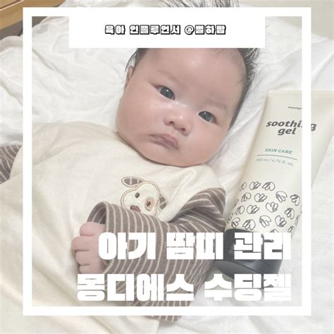 신생아 아기 피부 땀띠 없애는법 몽디에스 수딩젤 추천 네이버 블로그