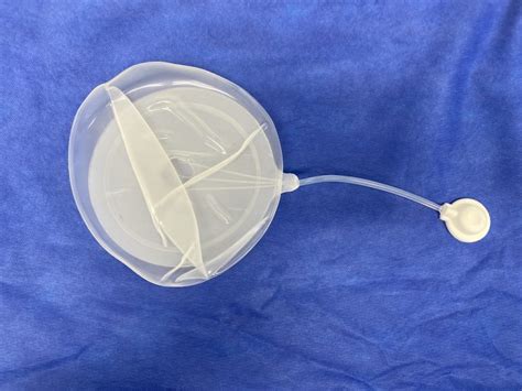 Scalp Expander Deflated Prior To Insertion Dr Barry Eppley Explore