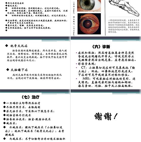 颅内压增高与脑疝ppt模板 卡卡办公