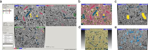 Autocontext Segmentation In Ilastik A Overview Of The Ilastik Window Download Scientific