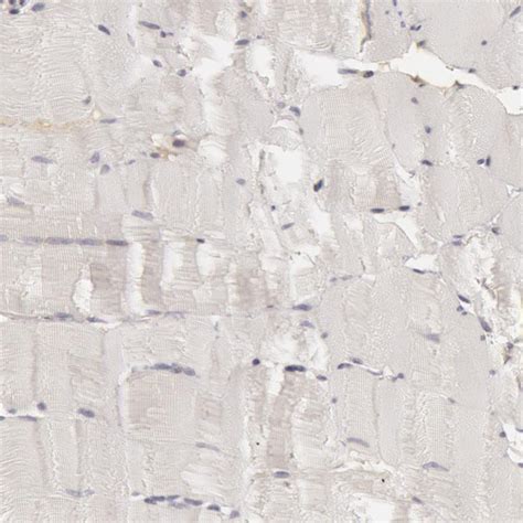 Rabbit Polyclonal Anti C7 Antibody Buy For Research Highly Specific Rigorously Validated