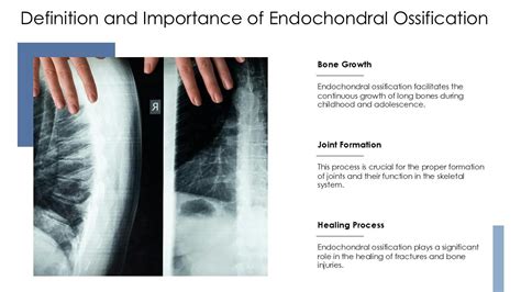 Definition And Importance Of Endochondral Ossification Ppt Powerpoint Acp Ppt Slide