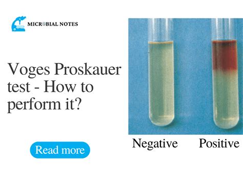 Voges Proskauer Test How To Perform It Microbial Notes