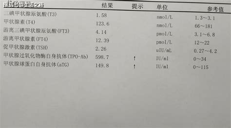 抗甲状腺球蛋白抗体高是桥本病吗？要治疗吗？患者