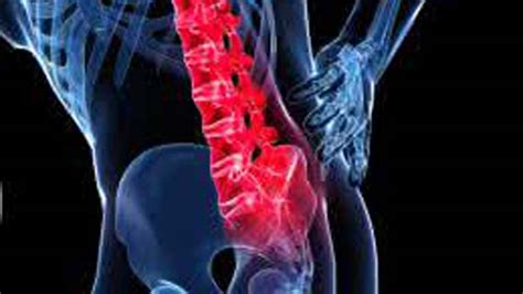 巧治坐骨神经 坐骨神经针灸一针见效 坐骨神经痛打一针就好 大山谷图库