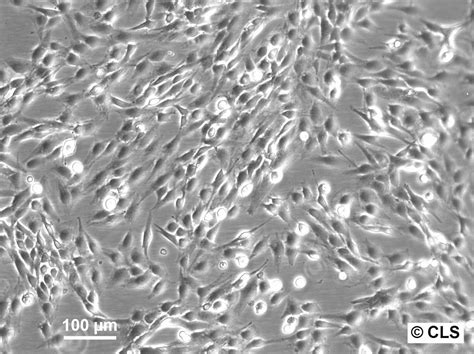 ccf sttg1 cells