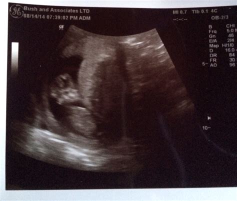 Skull Theory Boy Or Girl Glow Community Skull Theory Boy Or Girl Glow Community