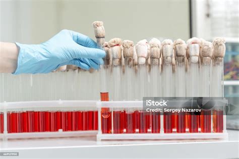 손 들고 혈액 튜브 테스트 및 배경 혈액 튜브 랙 실험실 기술자의 다른 환자 샘플 간호사에 대한 스톡 사진 및 기타 이미지 간호사 색상 견본 수집 Istock