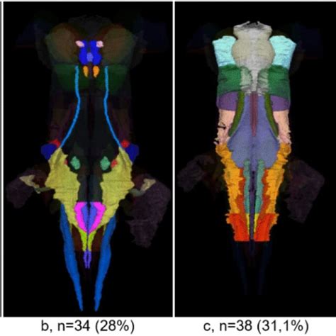Anatomical Groups Of The Segmented Gray Matter Structures For One Download Scientific Diagram