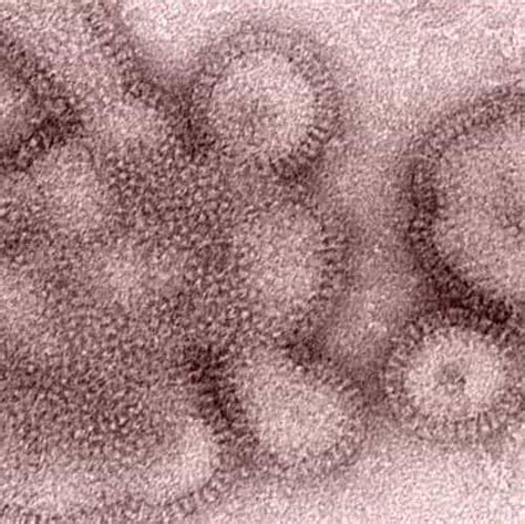 Selection Screen Function Key N Abapinho