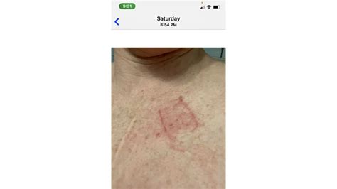 Cardionet Review Biotel Mcot Complaintsboard