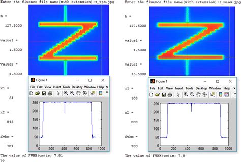 Quality Assurance Of Linear Accelerator A Comprehensive System Using Electronic Portal Imaging
