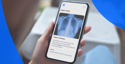 How To Read An X Ray Report Lucency Acute Osseous Abnormality More