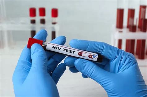 3 Jenis Tes Deteksi Virus Hiv Aids Gejala Hingga Penyebab Yang Perlu