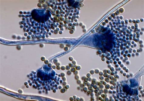 Aspergillus Vircell