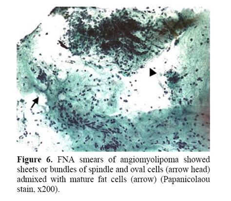 The Differential Broadens Eus Fna Appearance And Cytological Fin
