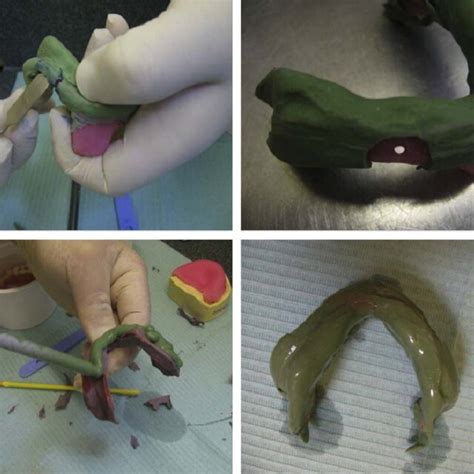 A Selective Pressure Impression In Preparation Top Left The