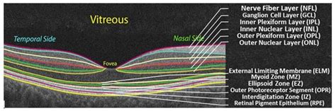 Retinal Layers Oct