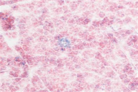 Reprogrammed T Cells Can Eliminate Senescent Cells