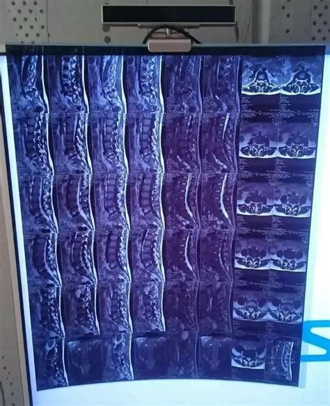 如何让患者用手机翻拍高质量x片?赶紧收藏! 德医医学 助力医学教育发展! 如何让患者用手机翻拍高质量x片?赶紧收藏! 德医医学 助力医学教育发展!