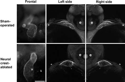 Cardiac Neural Crest Ablation Causes Failure Of Looping In A Subset Of